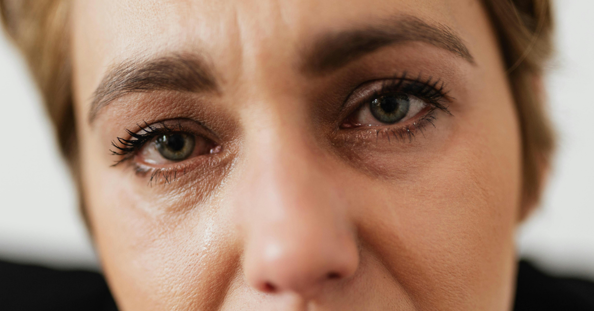 Scopophobia Explained - Navigate Your Fear of Being Watched